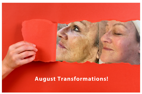 Collagen Lift Facial Transformation