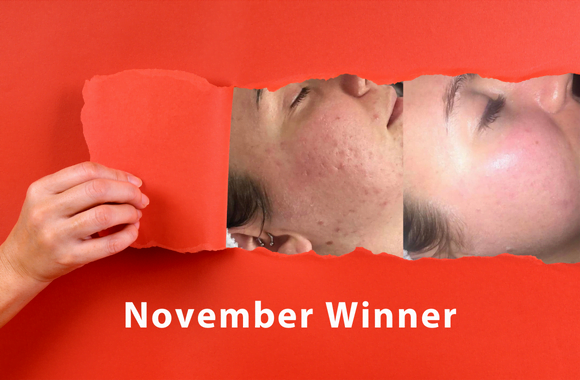 Our November Winner - and Finalist!