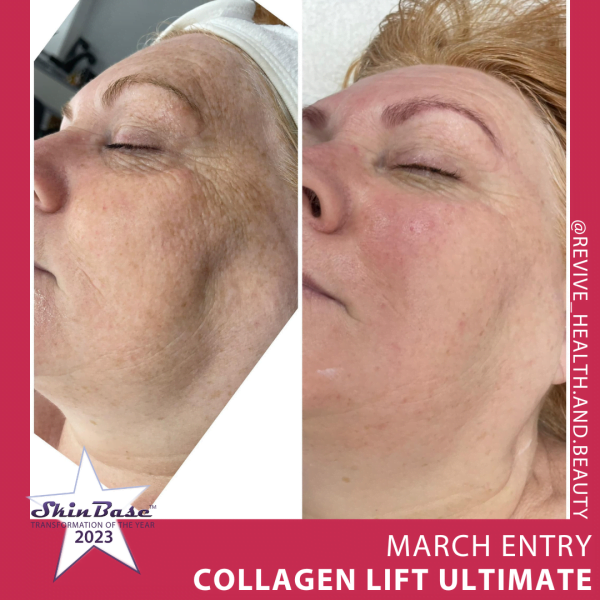 Collagen Lift Ultimate Transformations