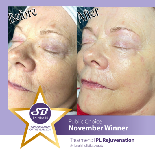 November Winners: Transformation of the Year 2024